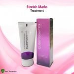 स्ट्रेच मार्क्स कैसे हटाये ? Plasma Pen Se Stretch Marks Kaise Hataye